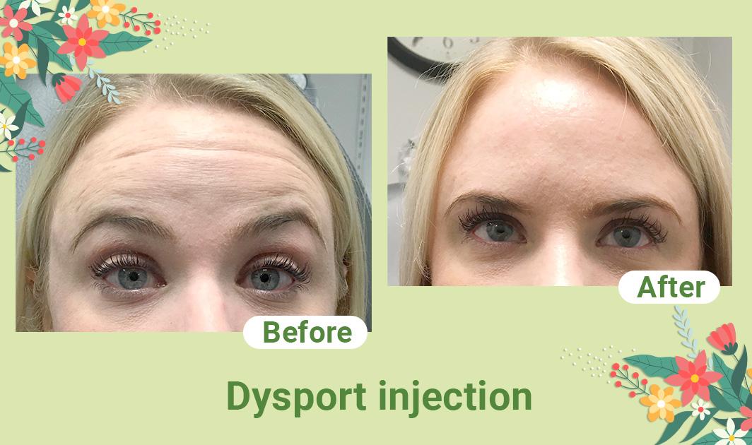 Seattle Plastic Surgery's Best Monthly Specials